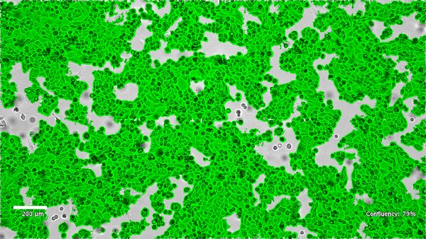 HCC95 Human Lung Squamous Carcinoma Cell Line | SCC483